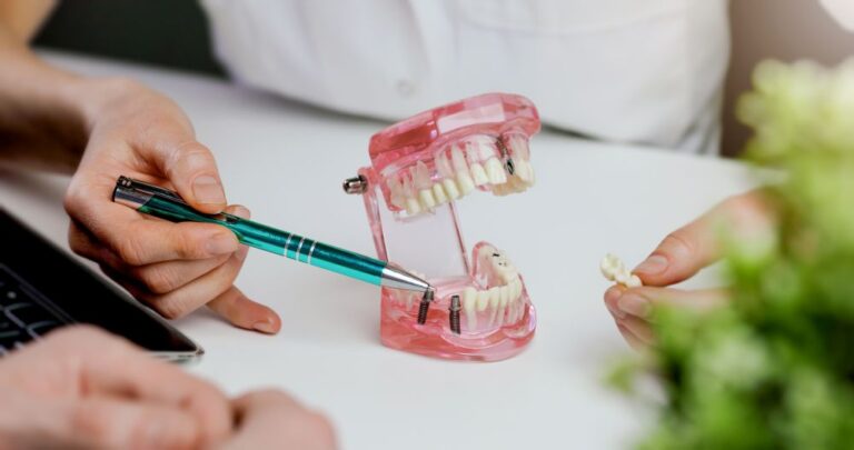 Dental Definitions: What Do These Common Implant Terms Mean? | Baldwin ...